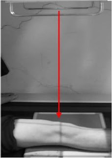 Proyeksi pemeriksaan Genu | Aditya Radiografer