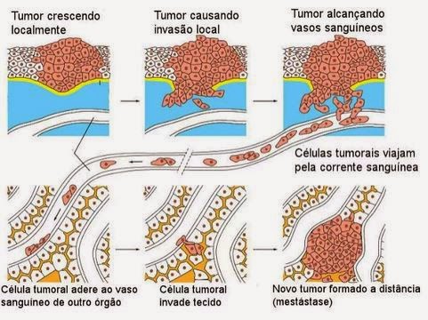 CURIOSIDADES MÉDICAS E CIENTÍFICAS: O QUE É O CÂNCER?