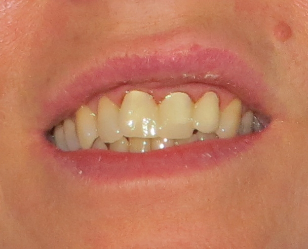 Travel Bug: Teeth! -- Tues., Feb. 5