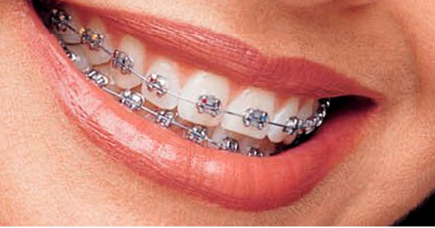 Brackets: Bienvenidos a Brackets
