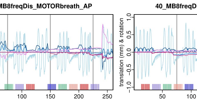 MVPA Meanderings: multiband acquisition sequence testing: respiration