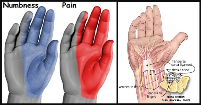Health Tips 12: Natural Remedies to Relieve Numbness in Your Fingers or ...