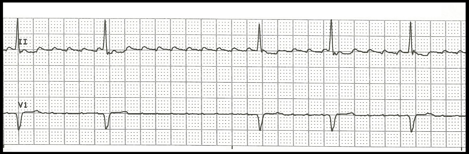 Float Nurse: Practice EKG Rhythm Strips 135