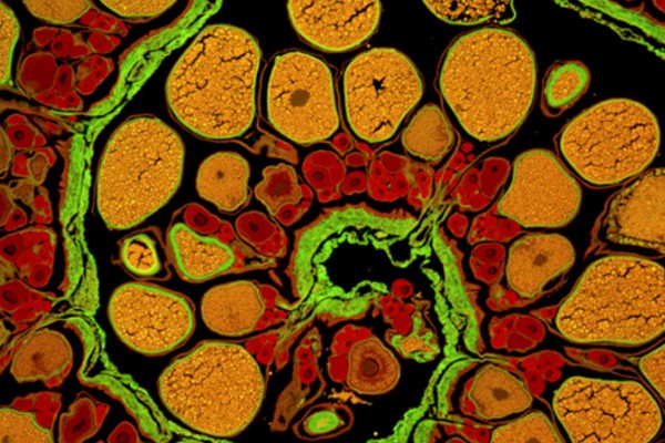 Imagenes asombrosas del mundo microscopico