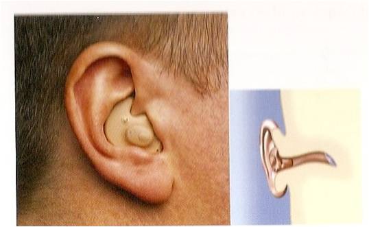 NEAE GRUPO6: Discapacidad Auditiva