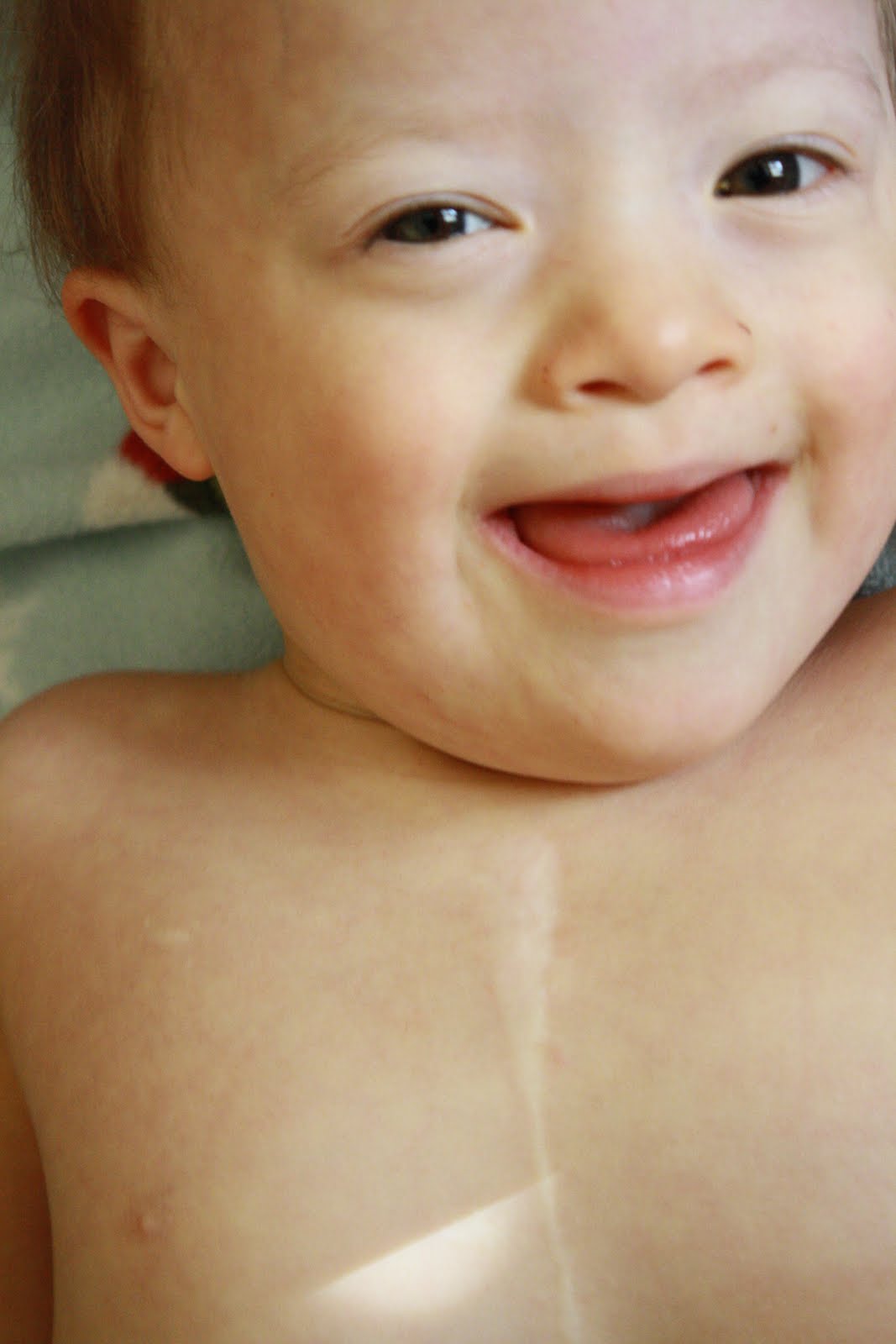 The Girl in the Zebra Pumps: These Scars