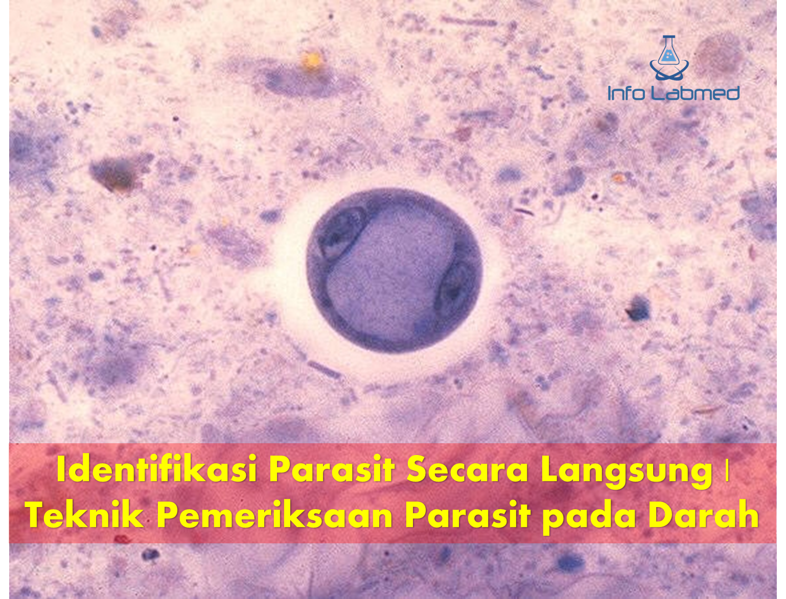 Identifikasi Parasit Secara Langsung | Teknik Pemeriksaan Parasit pada ...