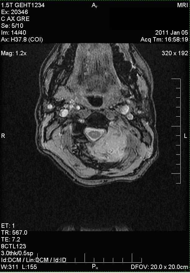 Just Keep Going: Neck MRI and CT scan images