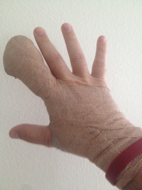 Nick's Myeloma Blog: A bit of finger...