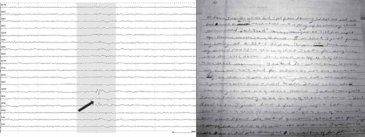 The Neurocritic: Textmania: a Modern Manifestation of Manic Hypergraphia?