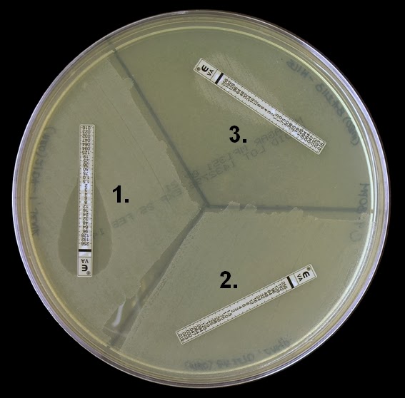 Enterococcus Urine Culture