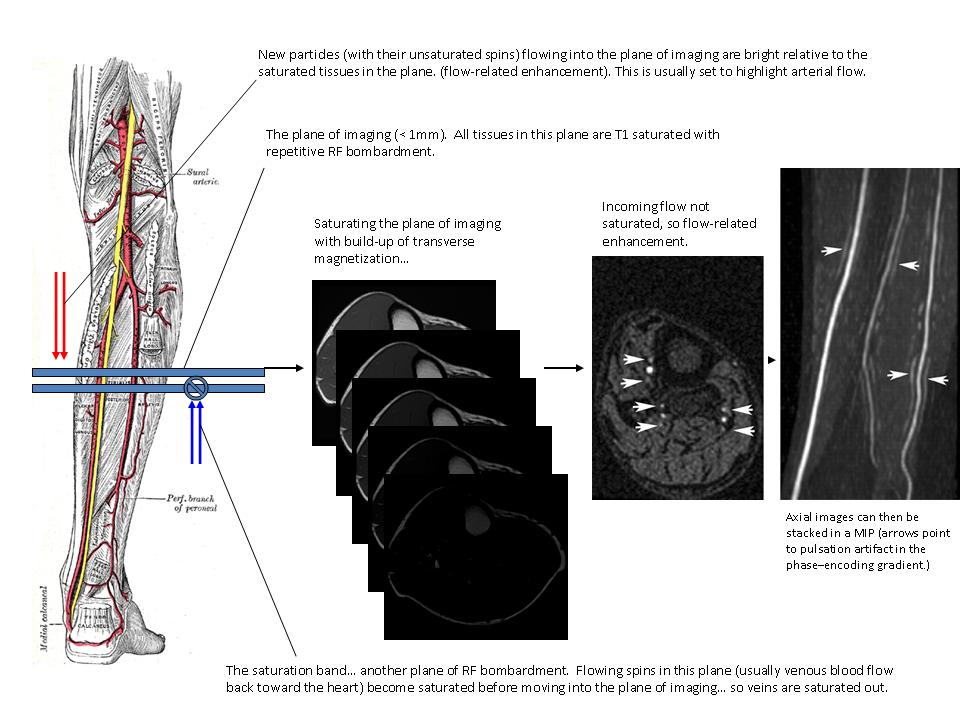 The Pump and the Tubes: Radiofrequency bombardment and vascular ...