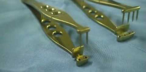 Eyelid Surgery by Prof Dr CN CHUA 蔡鐘能: Doctor, Do You Create Double ...