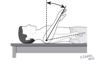 UW Shoulder and Elbow Academy: Is the shoulder stiff?