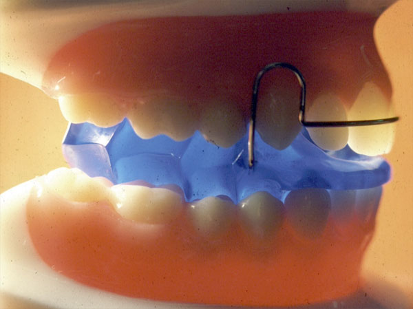 APARATOLOGIA ORTOPEDICA: BIONATOR ESTANDAR