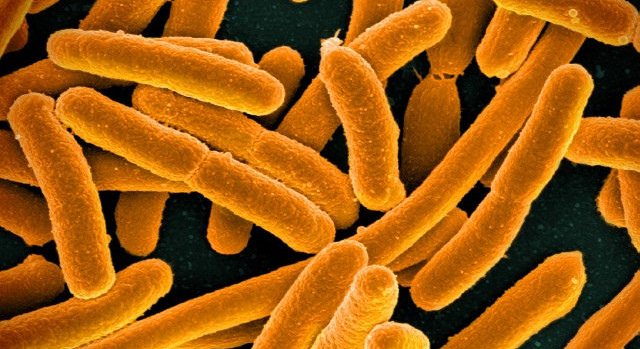 Contoh Klasifikasi Kingdom Monera