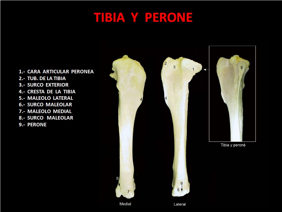 El caballo: El caballo