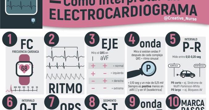 ZONA DE SALUD DE OFRA: Como interpretar un electrocardiograma Conceptos básicos. Fuente Cardioteca.