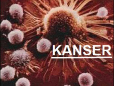 SIHAT DAN CERGAS: Tanda-tanda Awal Kanser