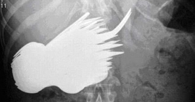 The 31 Most Ridiculous And Funny X-Ray Images You’ll Ever See