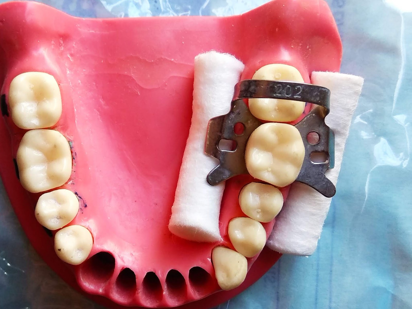 24 Ways to Retract the Tongue, Cheek and Lips