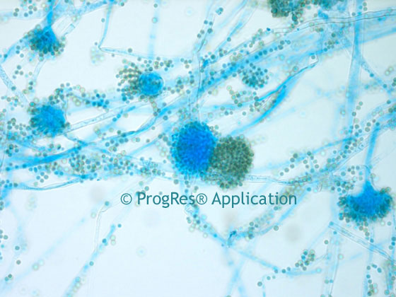 Microscope World Blog: Aspergillus (Mold!) under the Microscope