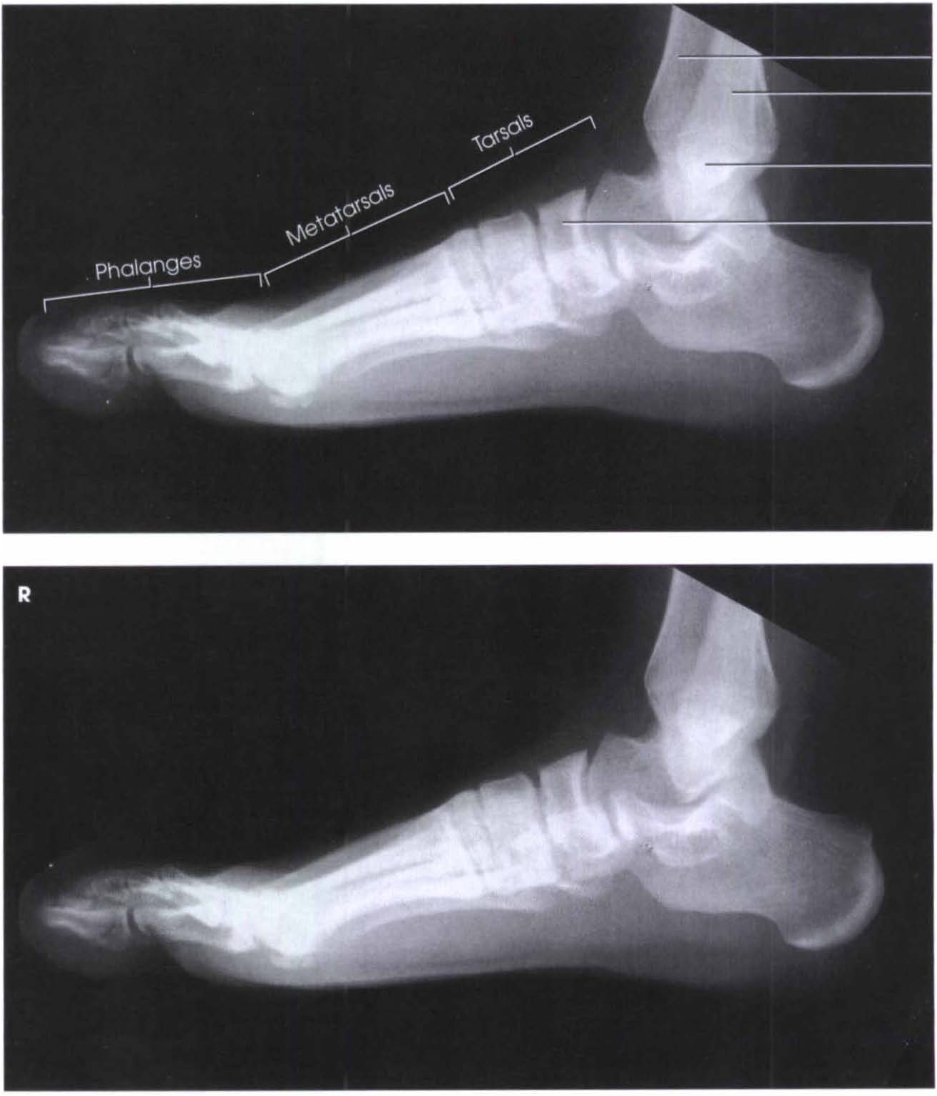 Gudang Medis: teknik radiografi pedis