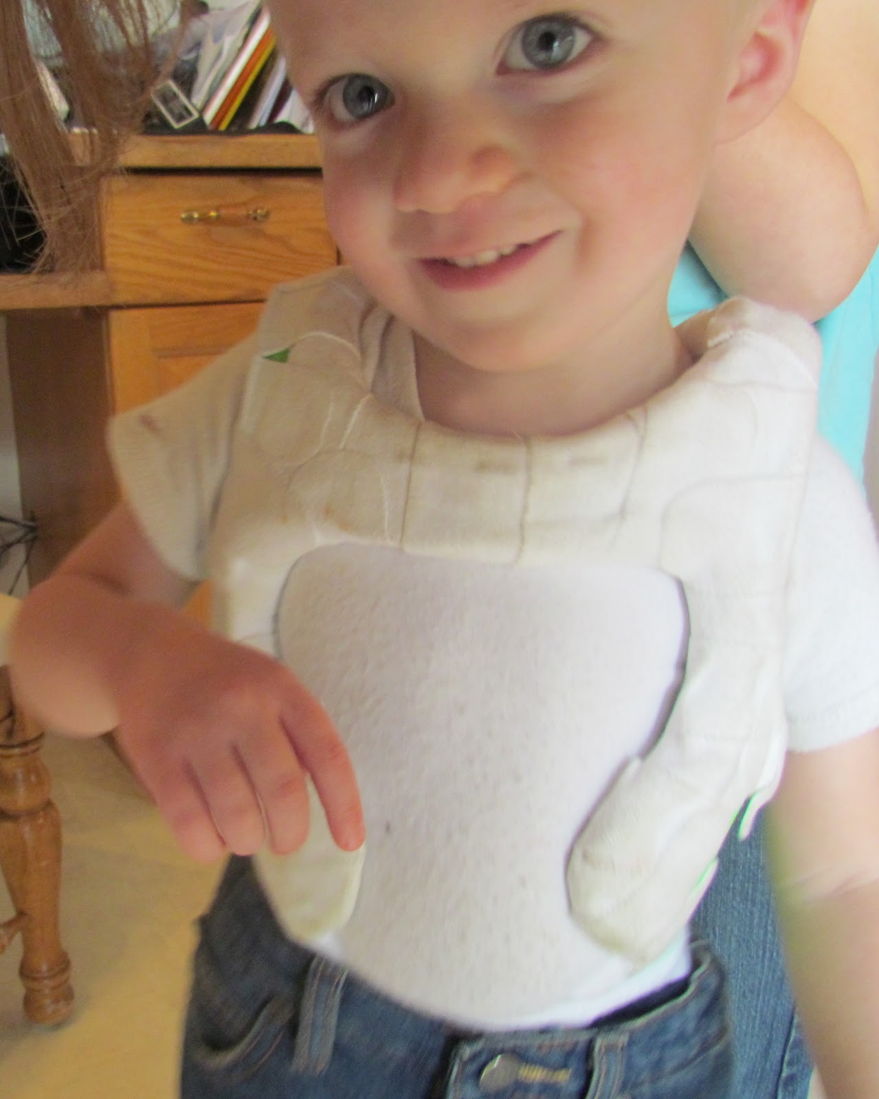 Our Journey through Progressive Infantile Scoliosis: Finally...Pictures ...