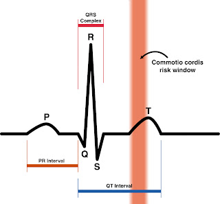 My Medical Notebook: Precordial Thump