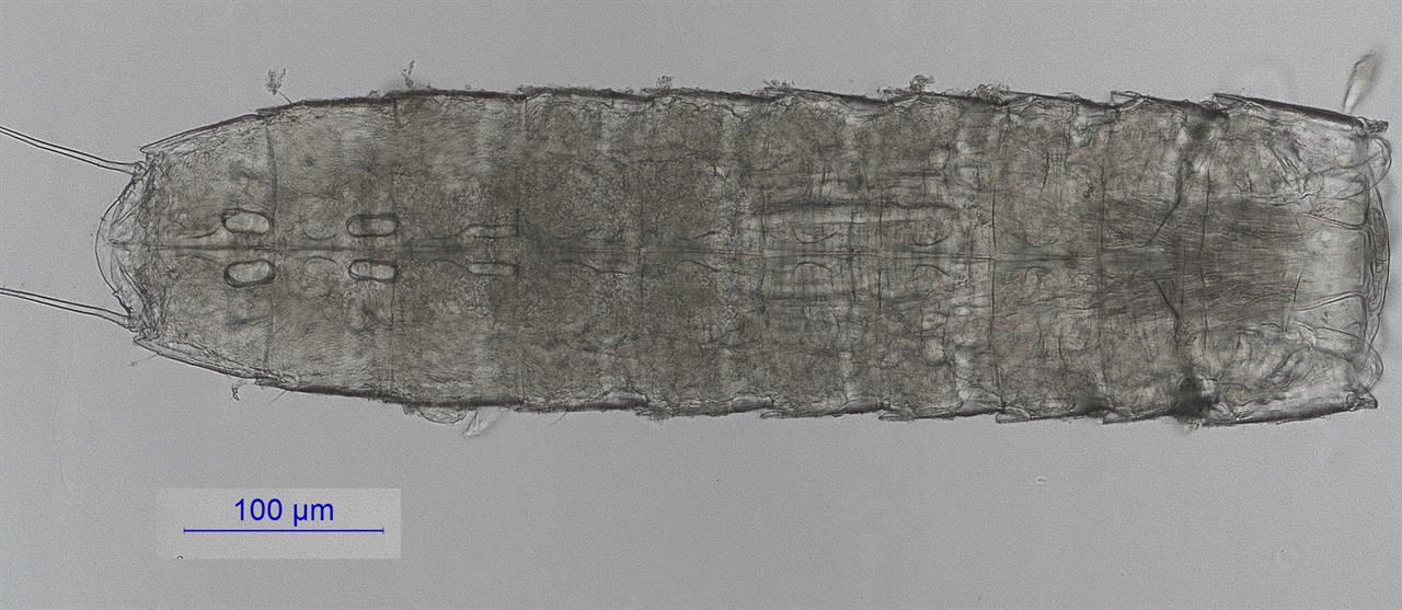 Kinorhyncha ~ Dunia Hewan