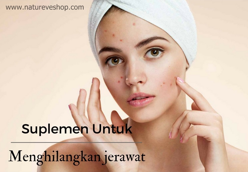 2 Suplemen Penghilang Jerawat yang Wajib Anda Coba - Natur Eve