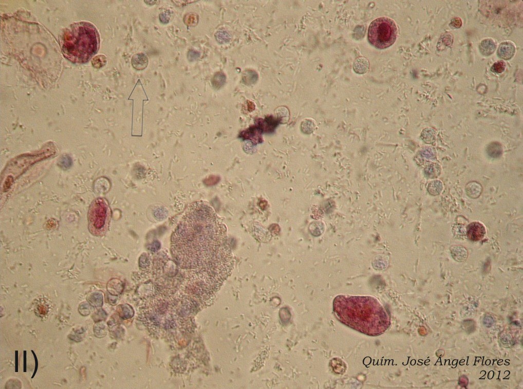 Examen General de Orina: diciembre 2012