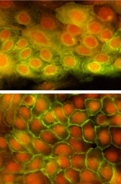 BIOLOGY WRITE-UP - BIOLOGY ARTICLES: Mystery of biology 8 : Polarity in ...