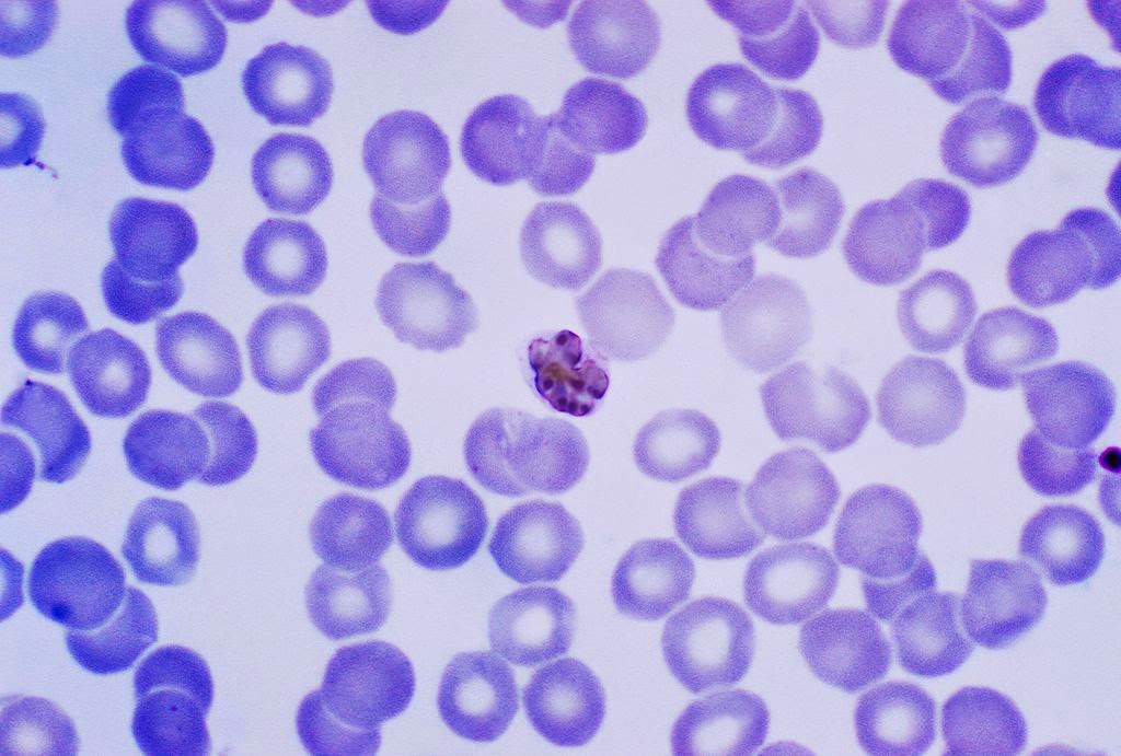 Fichero Hematología : Plasmodium malariae