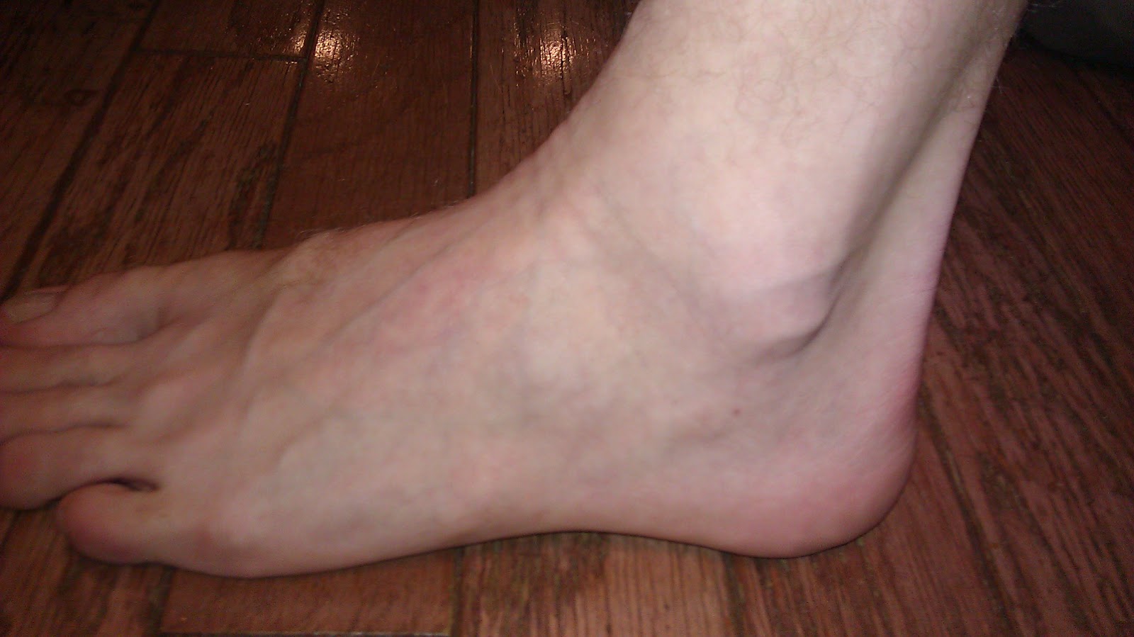 The Streak – Josh Stumpenhorst