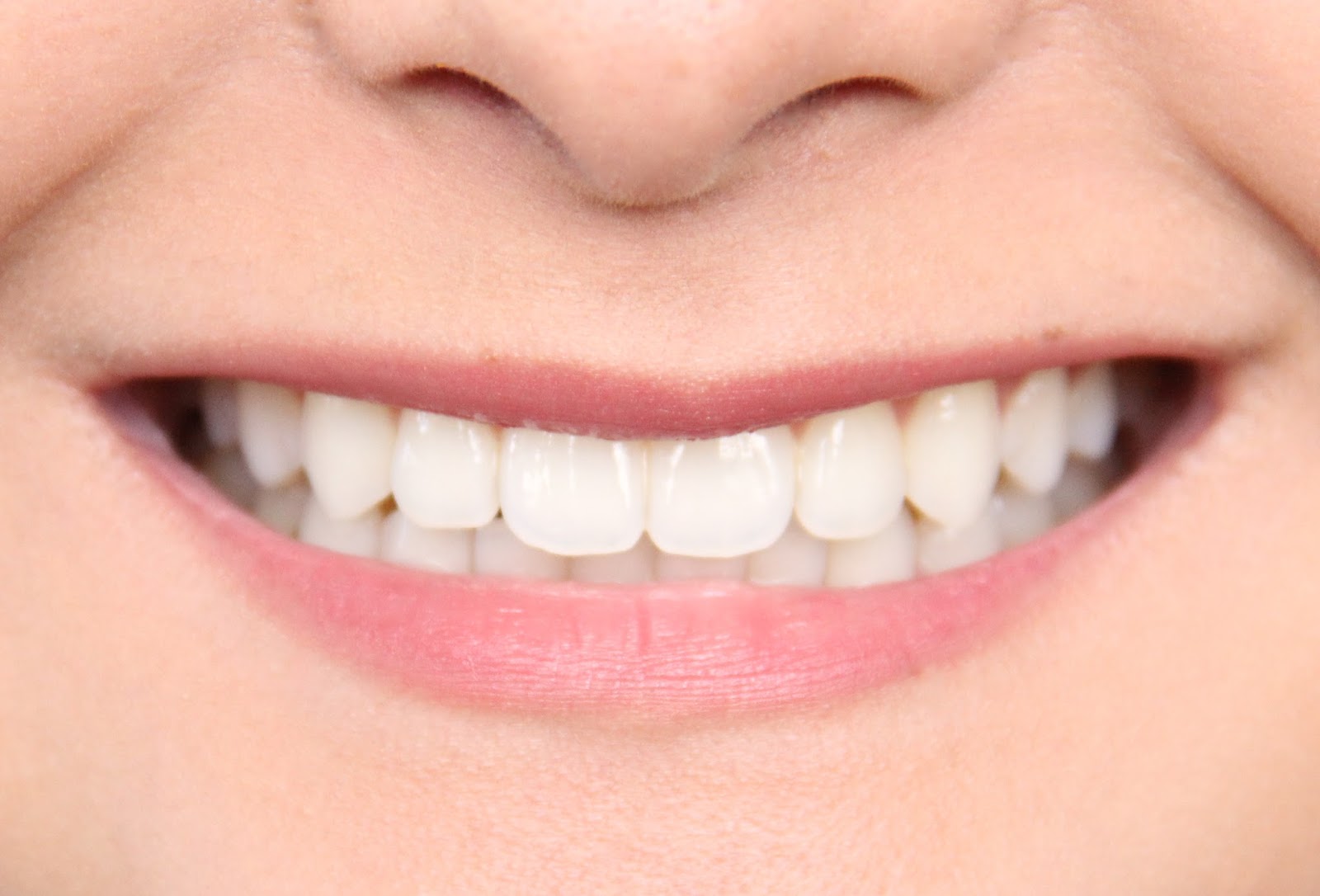 Smile Brilliant: Custom Teeth Whitening System + Giveaway - Elizabeth ...