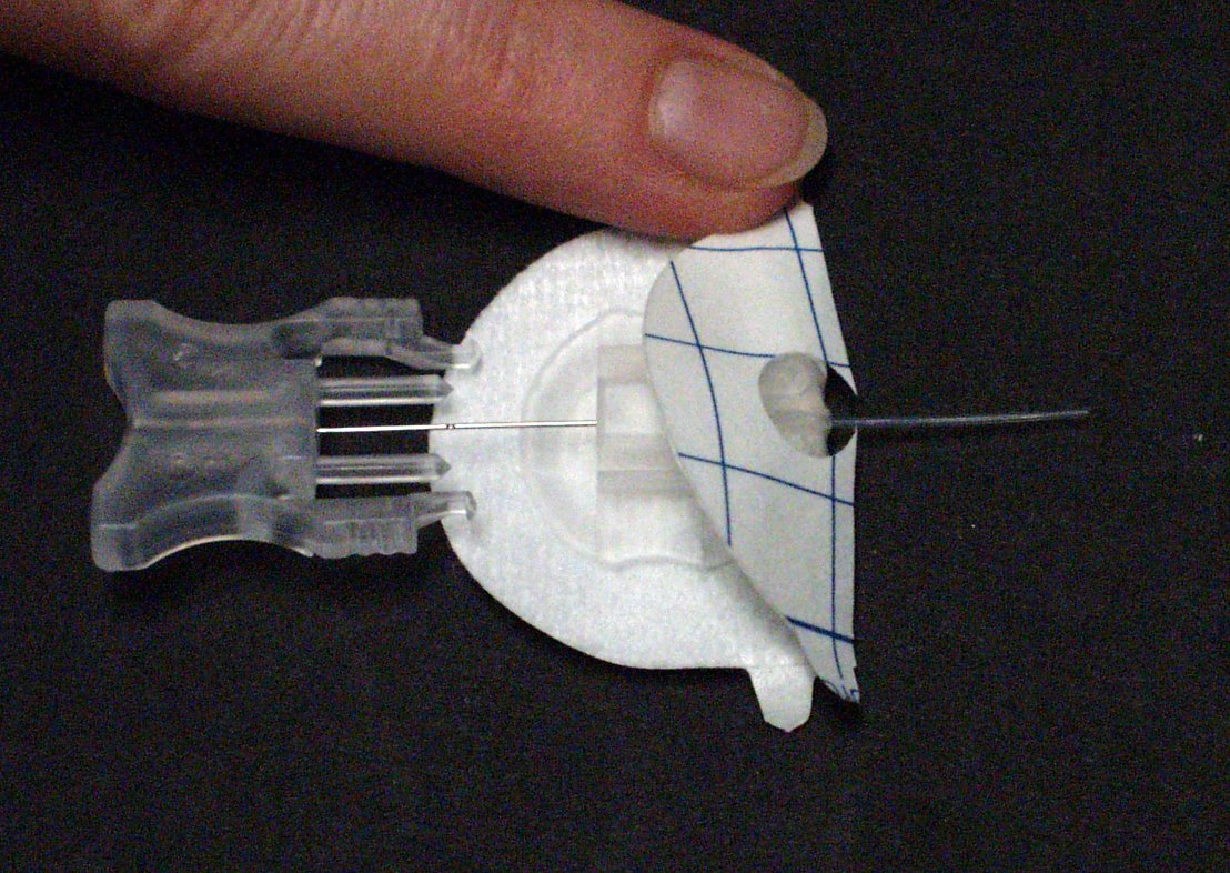 My fun with my insulin pump: Changing your infusion set