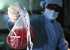 SOLYMONE BLOG: AUSTRALIA INVESTIGATES ORGAN TRAFFICKING