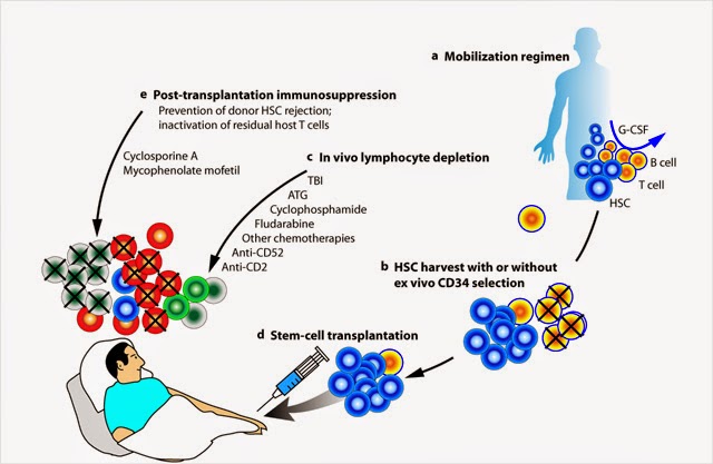 Drew's CIDP Story: Update 43 - HSCT IS THE cure for CIDP! - The facts (1)