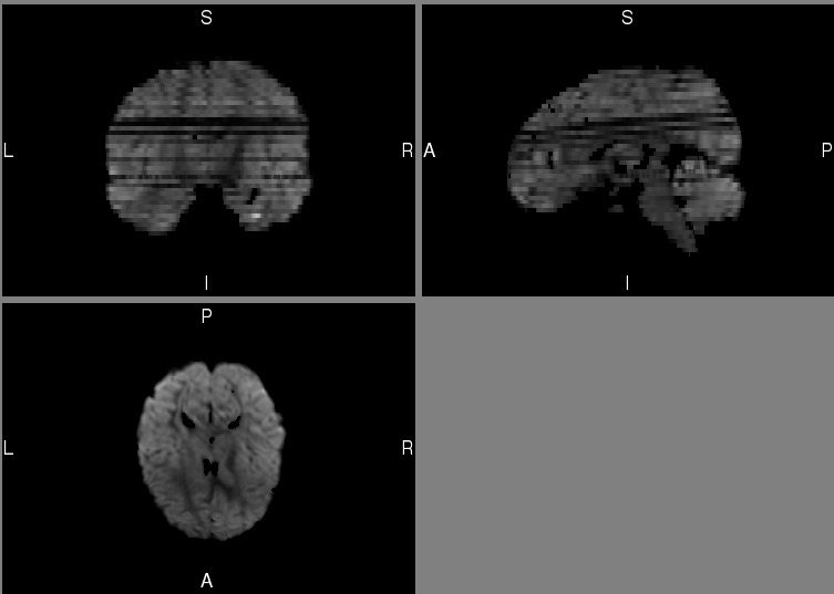 Dti Quality Control Part 1 Acquisition Diffusion Imaging Introduction Tutorials And