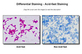 Microbiology : October 2017