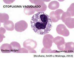 HEMATOLOGÍA