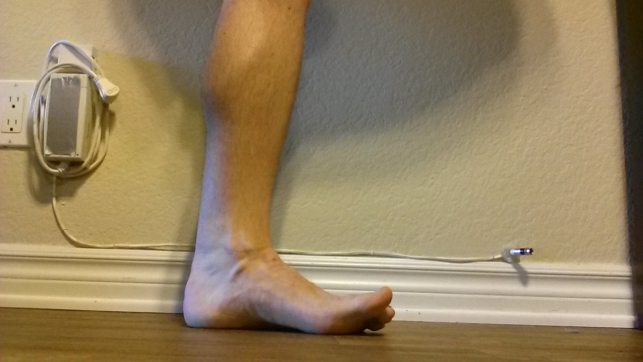 Midfoot Arch Support and the Posterior Tibialis - DOCTORS OF RUNNING