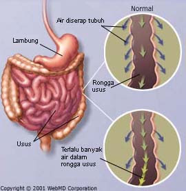 Pengertian Diare, penyebab, serta cara penanganan nya Lengkap - Berbagi ...