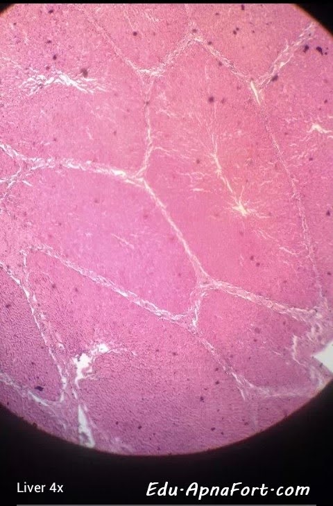 Educational Blog : Liver slides