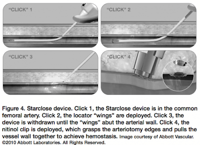 Vascular Mind : VASCULAR CLOSURE DEVICES