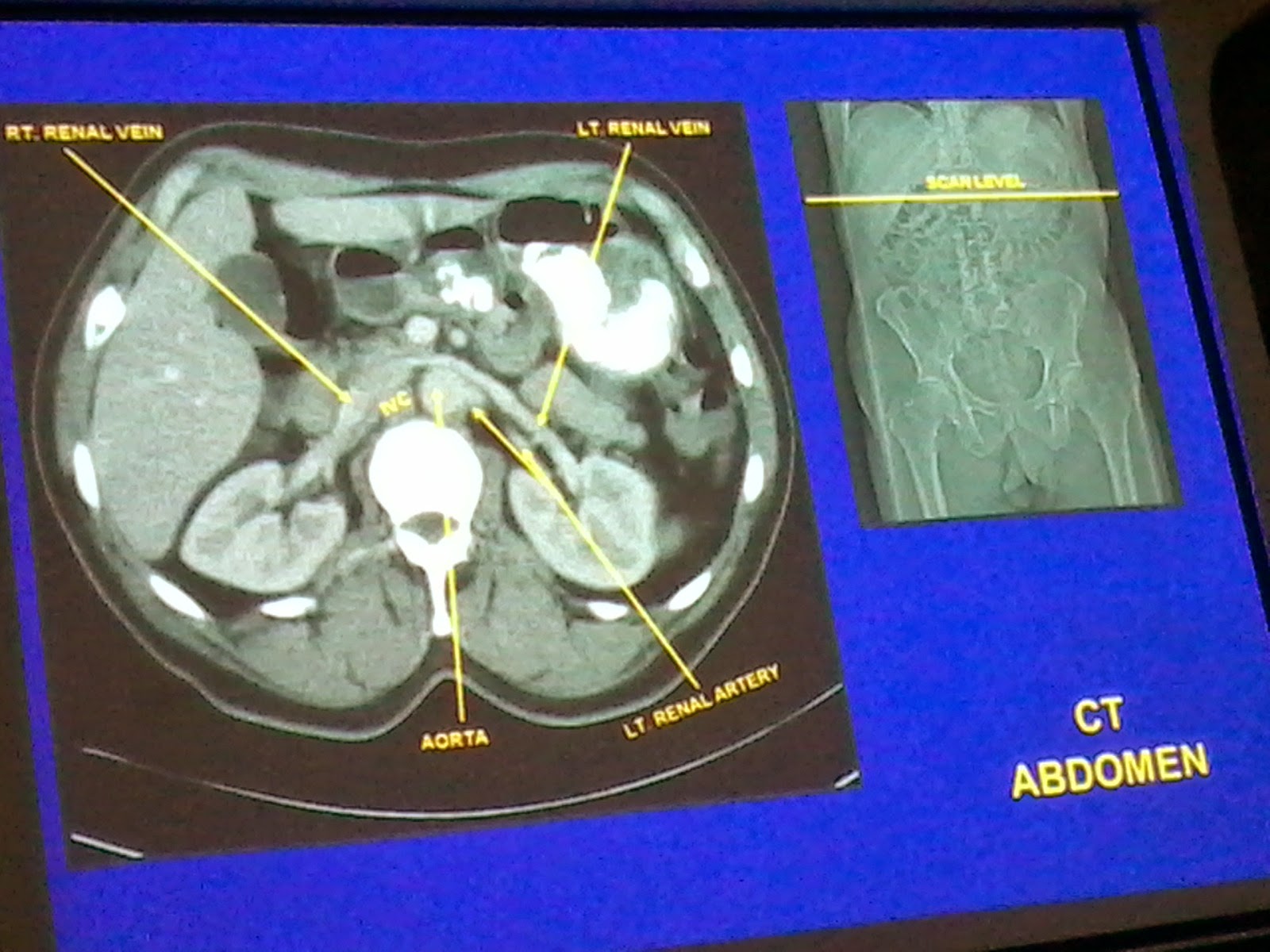 Lecture slides: Radiology: CT & MRI abdomen