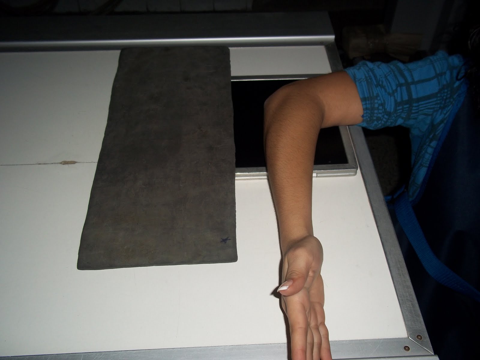 rayos x 2011: CODO Proyección Lateral LATEROMEDIAL