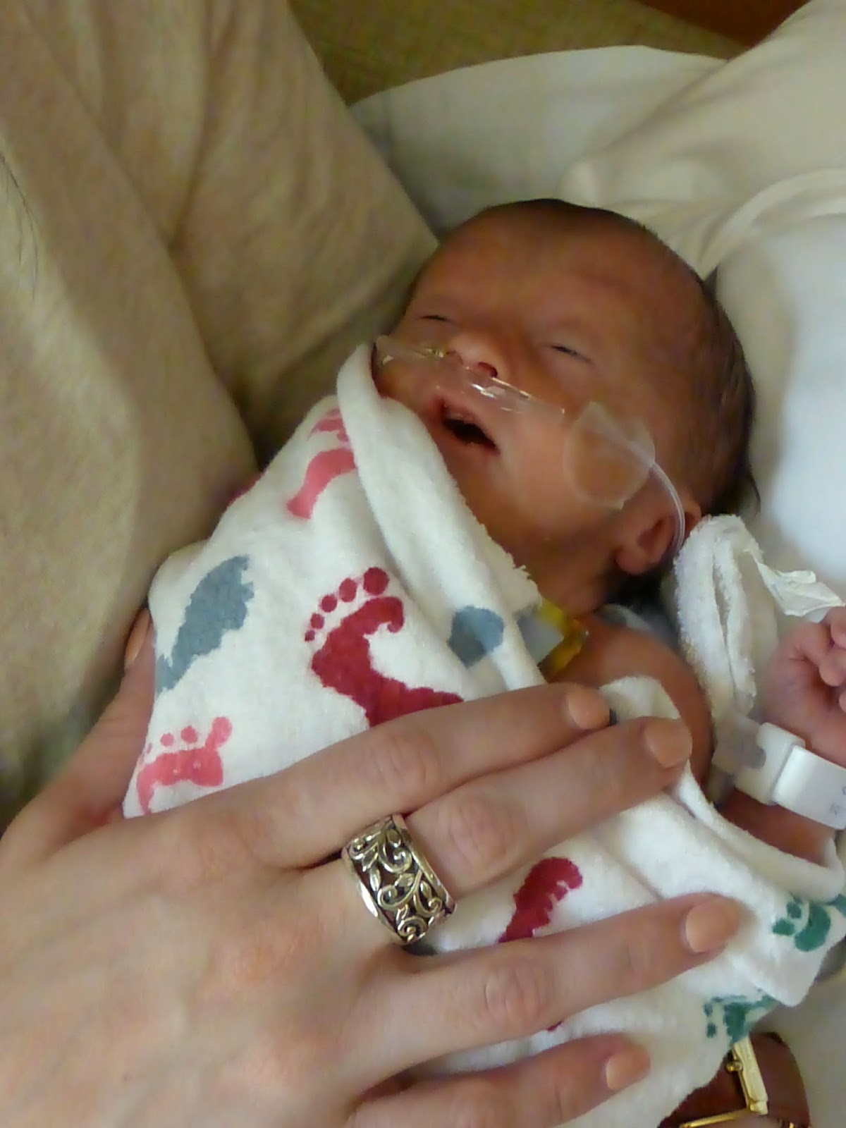 Cherishing Elise: Carrying and Loving Our Trisomy 18 Baby: Elise ...