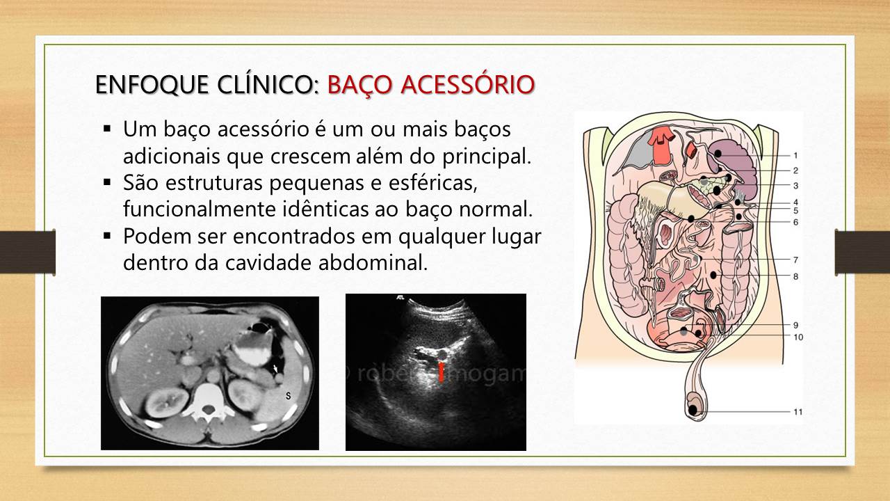 Liga de Anatomia ULBRA: BAÇO